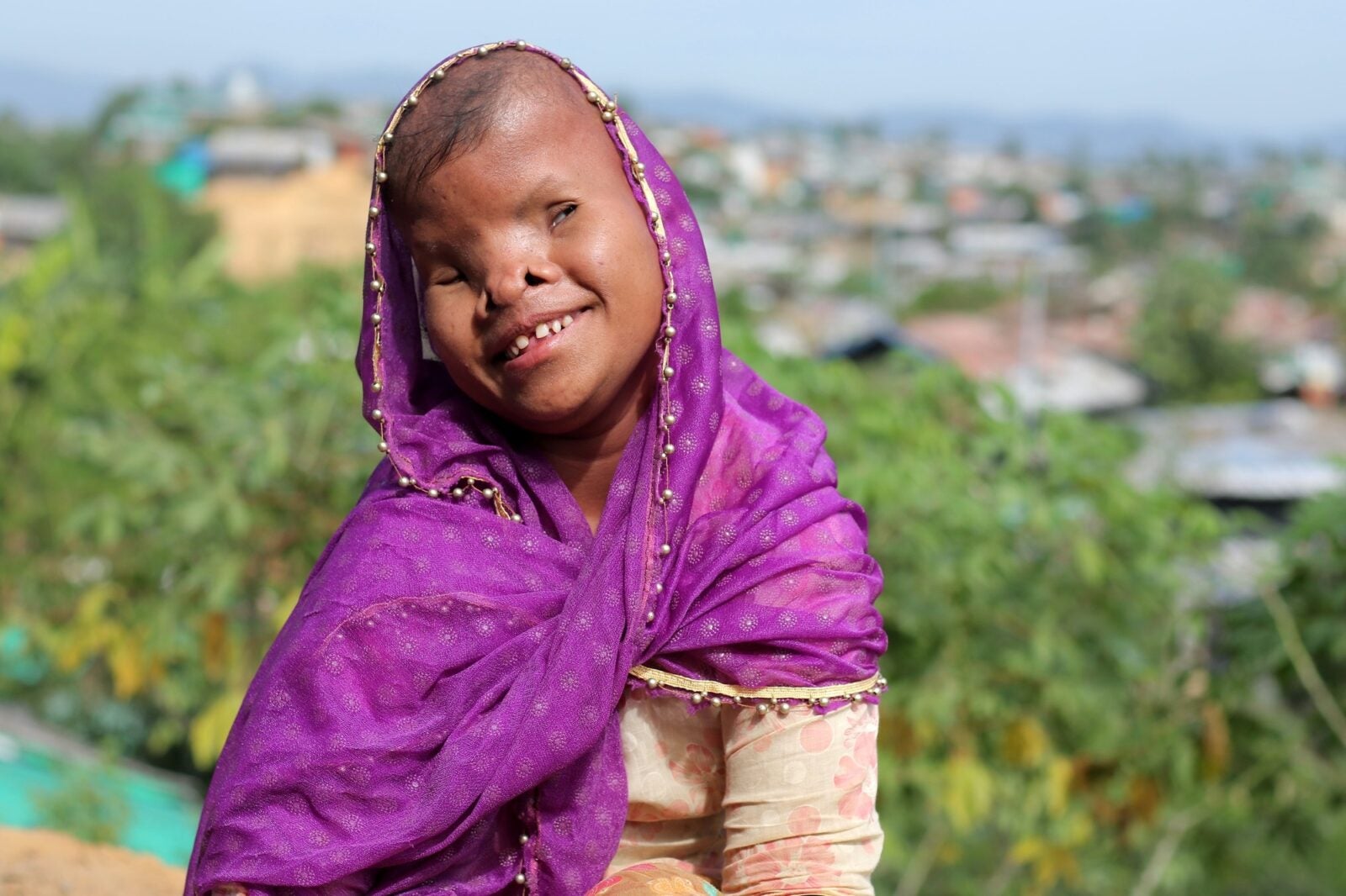 Refugee Camp Difficulties Intensified for Those with Disabilities - CARE